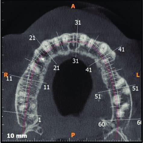 Cone Beam Computed Tomography Records Anatomical Structures Three Download Scientific Diagram