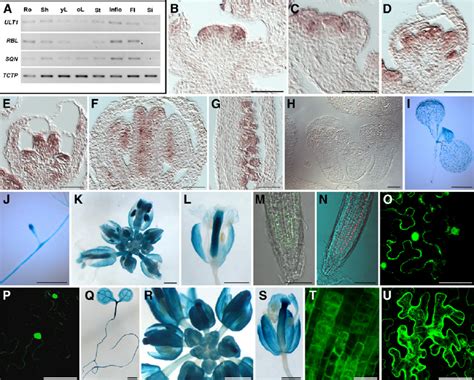 Expression Patterns Of The Three Genes And Subcellular Localizations Of Download Scientific