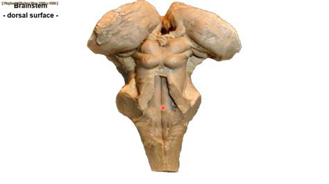 Brainstem Dorsal Diagram Quizlet