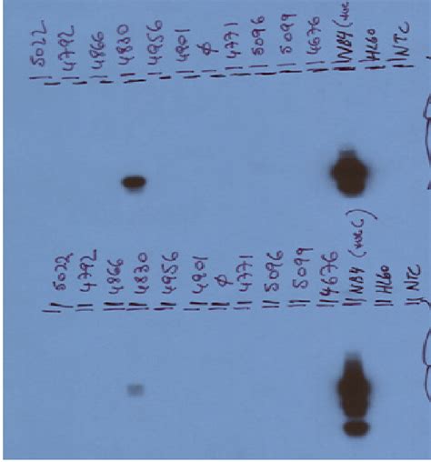C Auto Radiographic Film Showing Positive Pml Rara Fusion Gene In An Download Scientific
