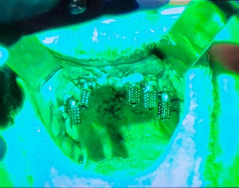 Photogrammetry Ottawa Dental Laboratory Il In And Wi