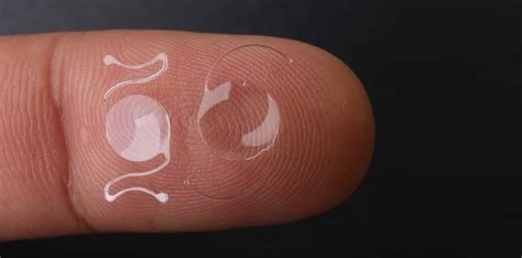 Iols Intraocular Lenses Ovo Lasik Lens Minneapolis