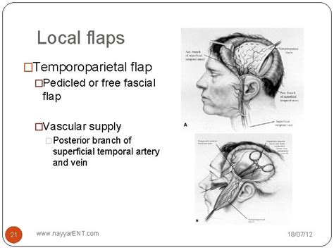 Grafts And Flaps In The Head And Neck