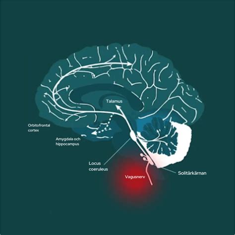 Vagus Nerve Stimulation V1 Nurosym