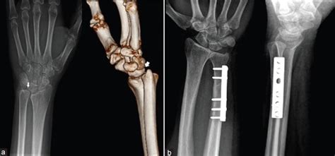 A X Ray And Computed Tomography Reconstruction Showing The Download Scientific Diagram