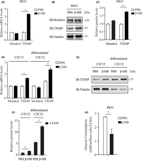 Ketone Bodies Promote Txnip Expression And Reduce Glucose Uptake A Download Scientific
