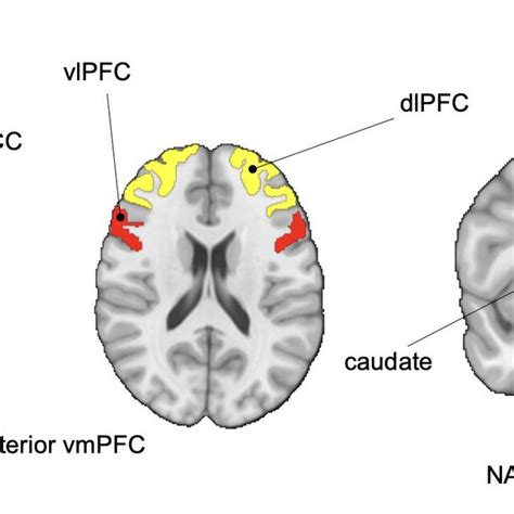 Antisaccade Task Schematic Download Scientific Diagram