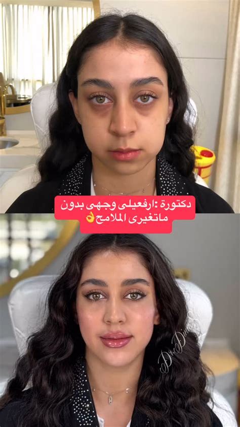 ‎rama Clinic For Dr Dinashawki عيادة راما تجميل د دينا شوقى