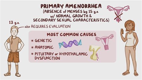 Approach To Primary Amenorrhea Clinical Sciences Osmosis Video Library