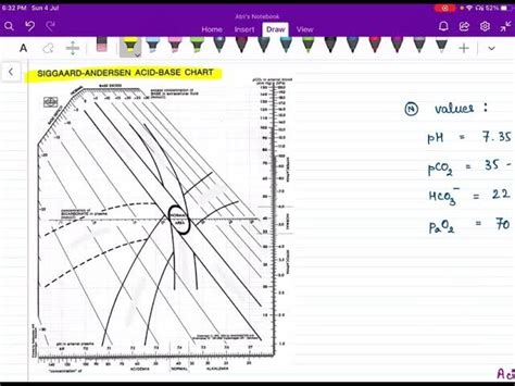 Acid Base Nomogram Development Of A Nomogram For Predicting