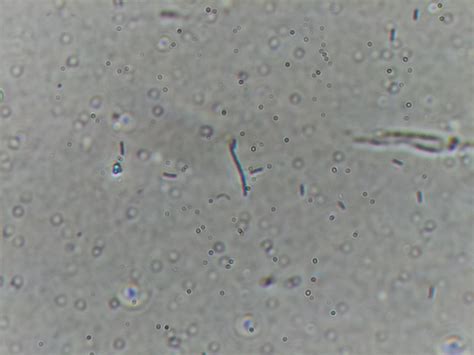 Ecoli Detection Object Detection Dataset And Pre Trained Model By Test