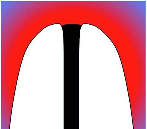 Eutectic Solidification Eutectic Solidification