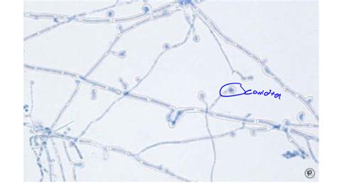 Mycology Iii Flashcards Quizlet