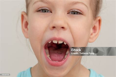 입을 크게 벌린 아이 얼굴은 회색 배경에 6세 7세의 백인 어린 소녀를 자른다 소녀에 대한 스톡 사진 및 기타 이미지 소녀 입 6 7 살 Istock