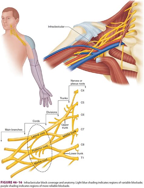 Infraclavicular Block