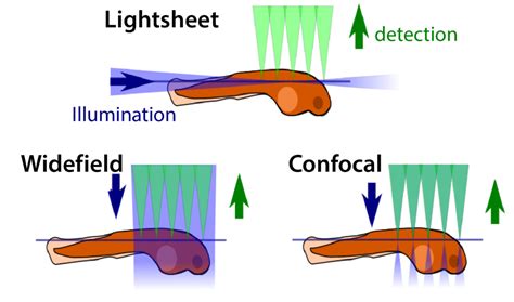 Selective Plane Illumination Microscopy Asi