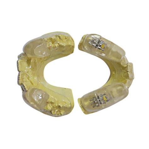 Khí Cụ Twin Block Ngược Tháo Lắp Tấm Essix