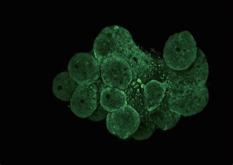 显微共聚焦系统在类器官及3d 细胞培养方面的应用 南京简智仪器设备有限公司