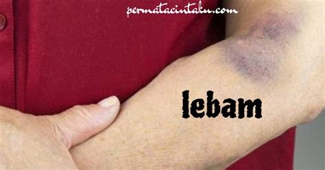 Good Health For Life Apakah Itu Penyakit ITP Adakah Cara Untuk Merawatnya Anda Perlu