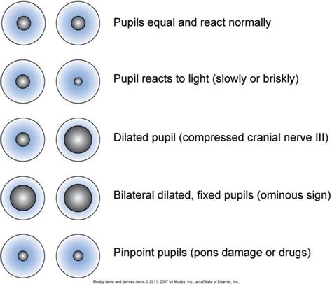 Pupillary Check Nursing School Tips Nursing School Survival Nursing