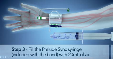 Preludesync™ Radial Compression Device Personal And Effective