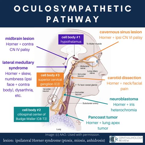 Ciliary Ganglion Pathways