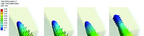 Micro Displacement Patterns Of Root Analogue Implants Rais In Each