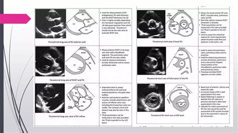 Echo Assessment Of RV Function PPTX