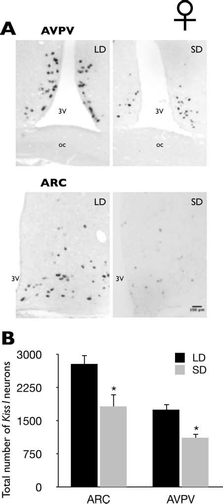 Effect Of Photoperiod On Kiss1 Expression In The Arcuate Nucleus Arc Download Scientific