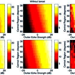 The Reduction Of Clutter Interference By The Lancet