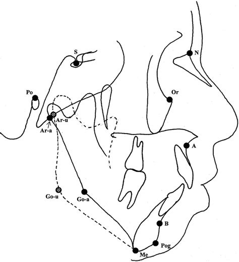 Reference Points Planes And Lines And Angles Used For The Lateral Download Scientific Diagram