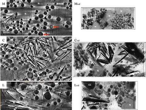Two Dimensional And 3d Representation Of The Cryo Fib Sem Stacks From M Download Scientific
