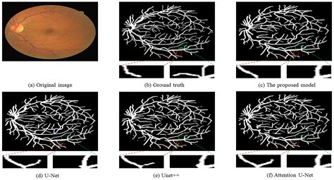a multi scale attention fusion network for retinal vessel segmentation