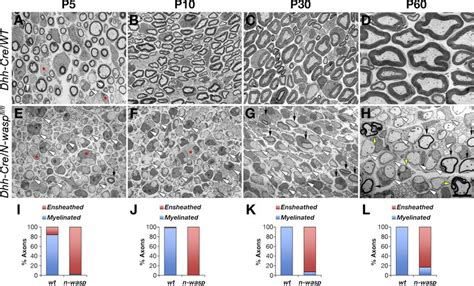 Developmental Analysis Of Peripheral Nerves Lacking N Wasp Ah Low