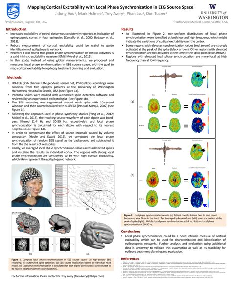 PDF Mapping Cortical Excitability With Local Phase Synchronization In EEG Source Space