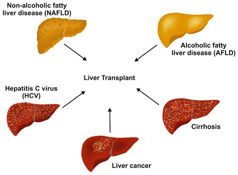 Recent Advances In Liver Tissue Engineering As An Alternative And Complementary Approach For