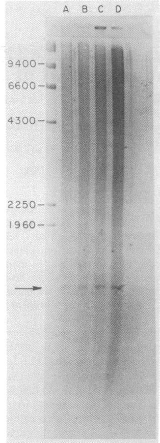 Figure 1 From Mouse Ecori Satellite Dna Contains A Sequence Homologous To The Long Terminal Figure 1 From Mouse Ecori Satellite Dna Contains A Sequence Homologous To The Long Terminal