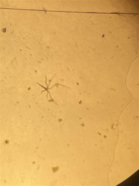 Does Anyone Know What This Is Found In A Fecal Float In A Shelter R Vettech