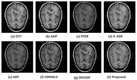 A Multi Modal Medical Image Fusion Framework Based On Two Scale