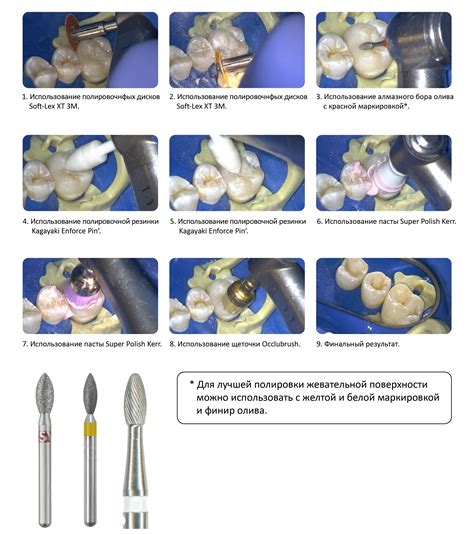 Escom 250 ЭсКом Малый набор купить цена композитный материал двойного отверждения Spident