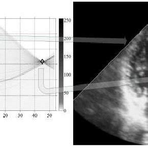 Line Detection Based On Hough Transform And Hough Space For A Single Line Download Scientific