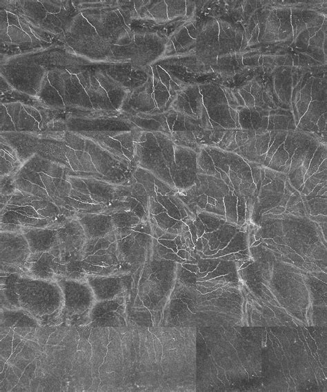 Directionality Vs Orientation J With Dominant Direction Image Analysis Image Sc Forum