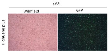 생화학 시약 Abclonal