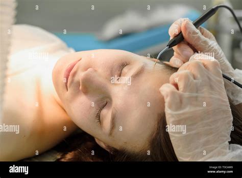 Medical Treatment Removal Of Birthmark From Female Patients Face