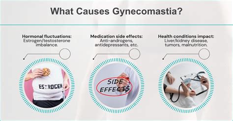 How To Know Gynecomastia Or Pseudogynecomastia 2025