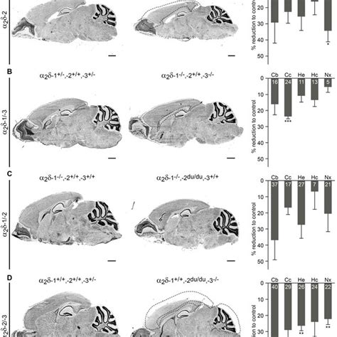 Volumes Of Distinct Brain Regions Are Decreased In Adult Ducky And α2δ
