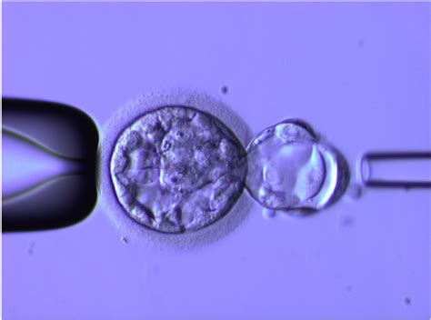 Pre Implantation Genetic Testing PGT GENESIS Reproductive Centre