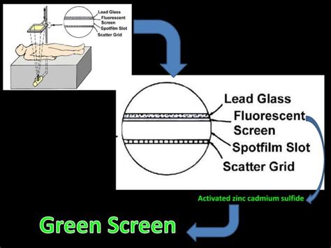 Fluroscopy Pptx Eye And Vision Conditions Diseases And Conditions