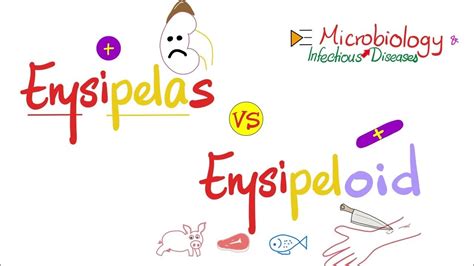 Erysipelothrix Vs Erysipelas Of Streptococcus Pyogenes Group A Streptococci Comparison Youtube