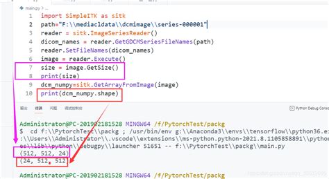 10 Simpleitk读取dcm格式维度变化sitkgetimagefromarray Csdn博客